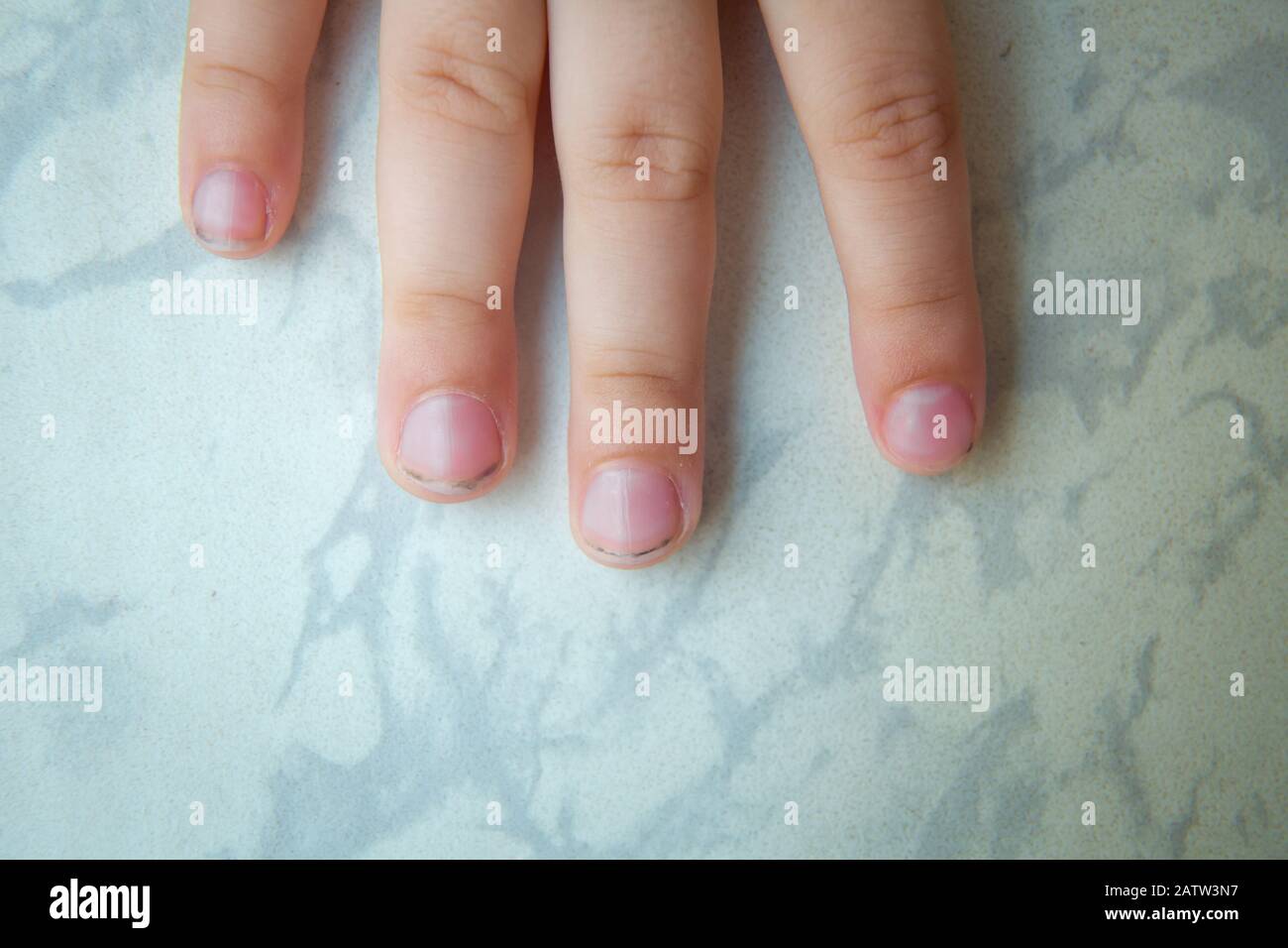 macro photo. Hand of a five year old child, five fingers . Five years ...