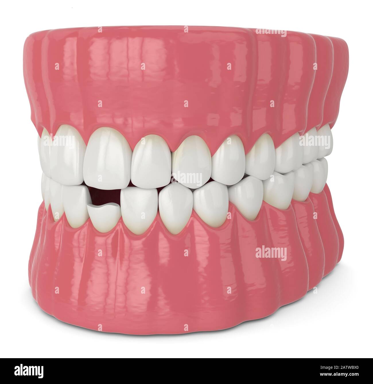 Lower teeth trauma hi-res stock photography and images - Alamy