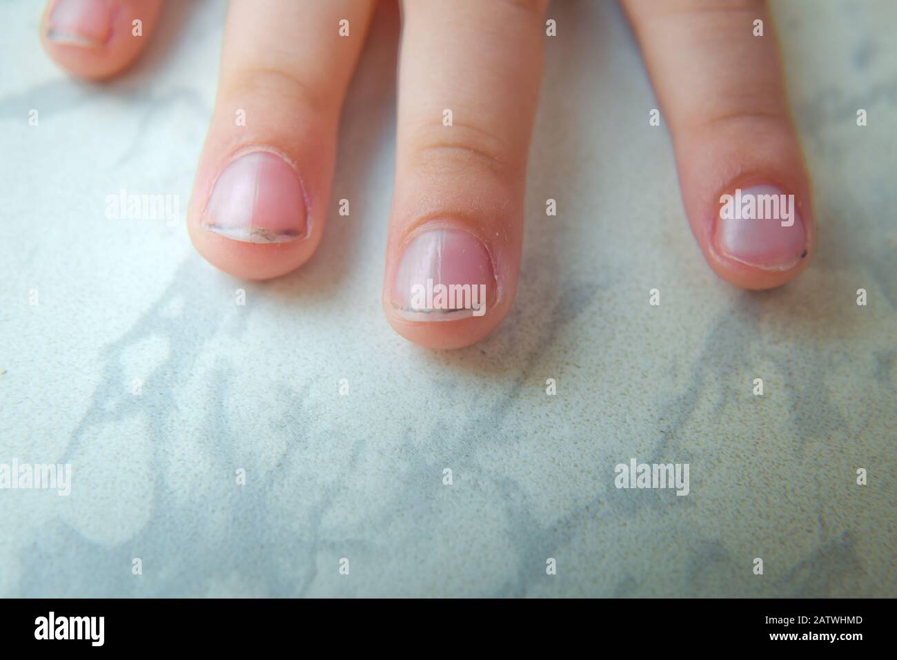 macro photo. Hand of a five year old child, five fingers . Five years ...