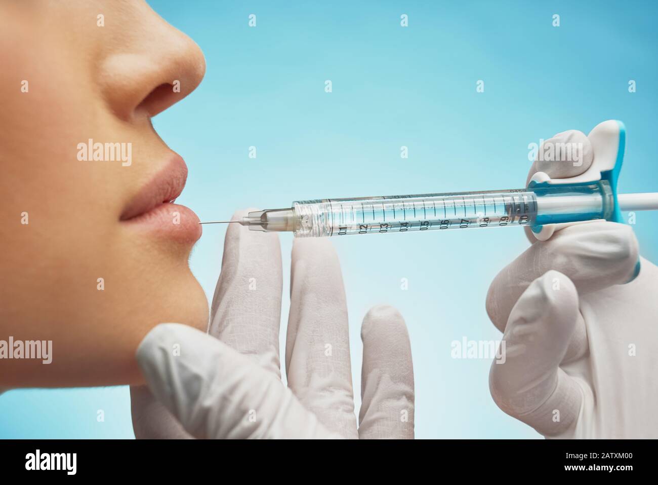 Close up of cosmetic botox injection in female lips. Side view of ...