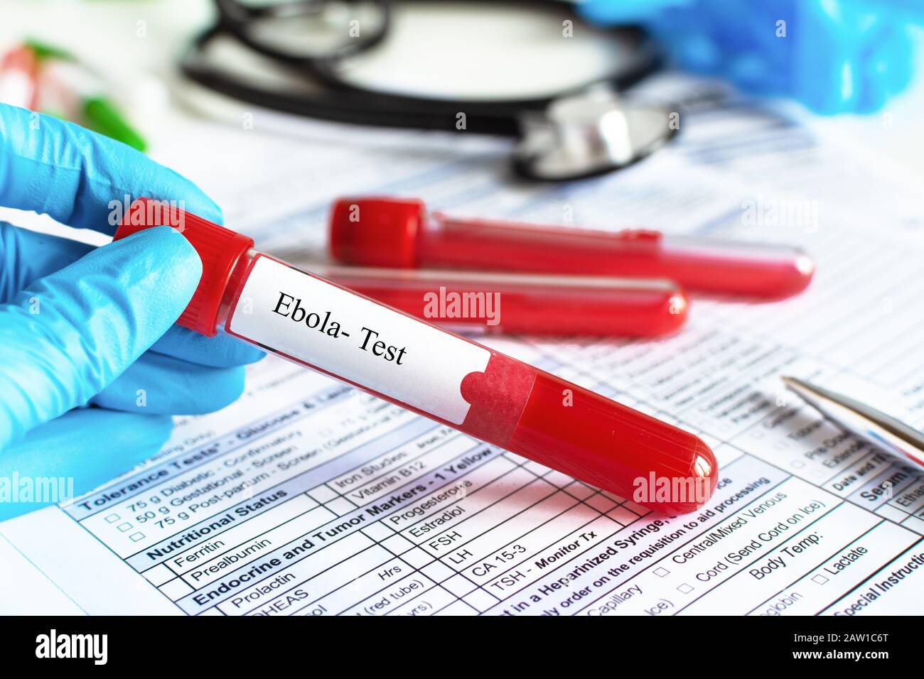 Blood vial hi-res stock photography and images - Alamy