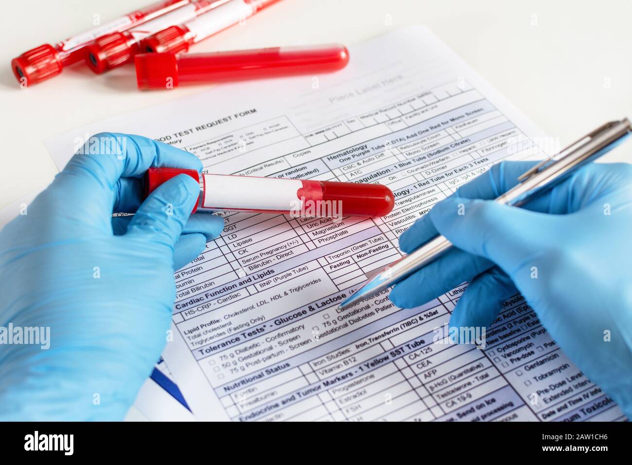 Biochemistry check hi-res stock photography and images - Alamy