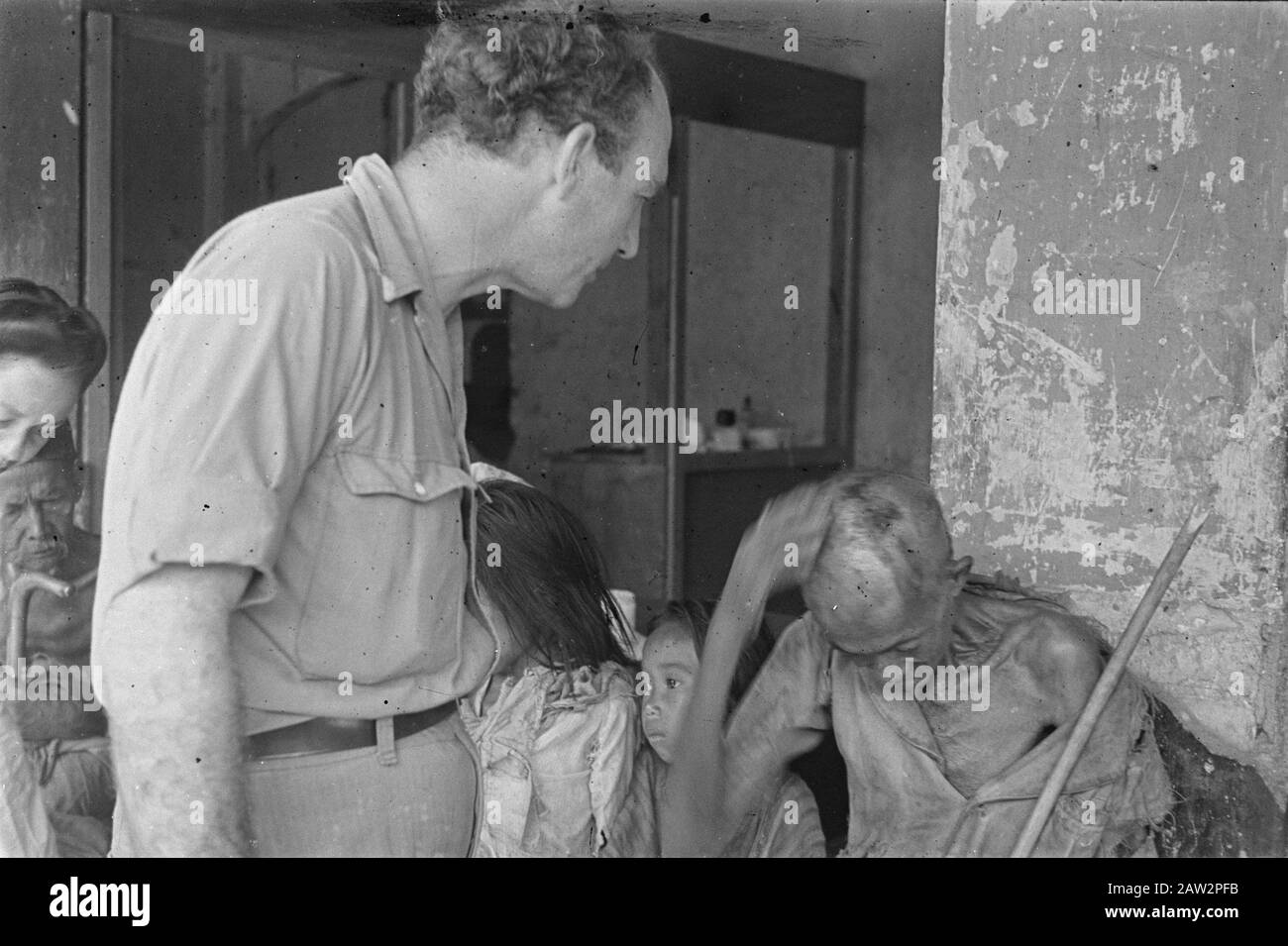 Photoreportage Palembang Outpatient? Elderly man shows his skull to a ...