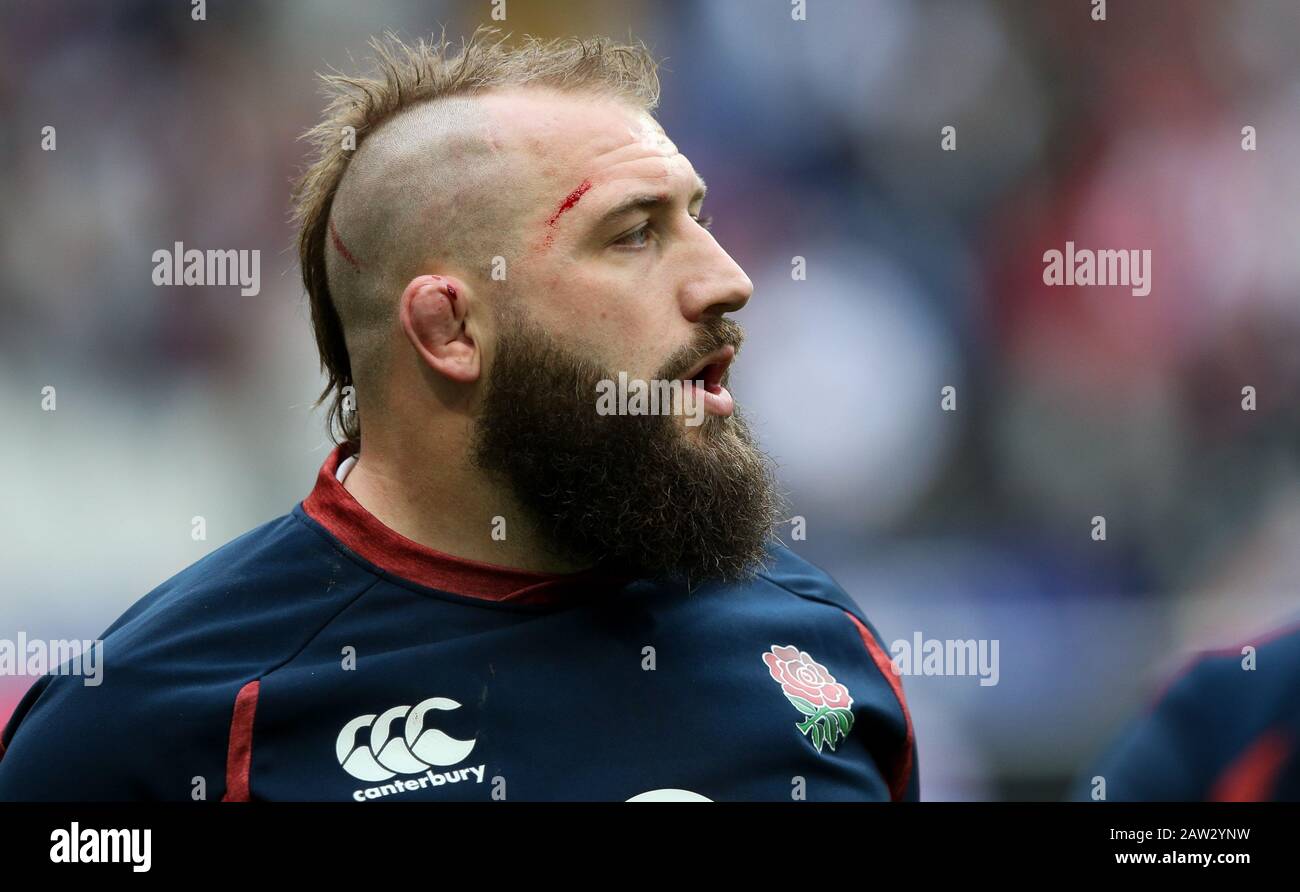 Joe Marler of England with gashes on his head after the warm up France ...