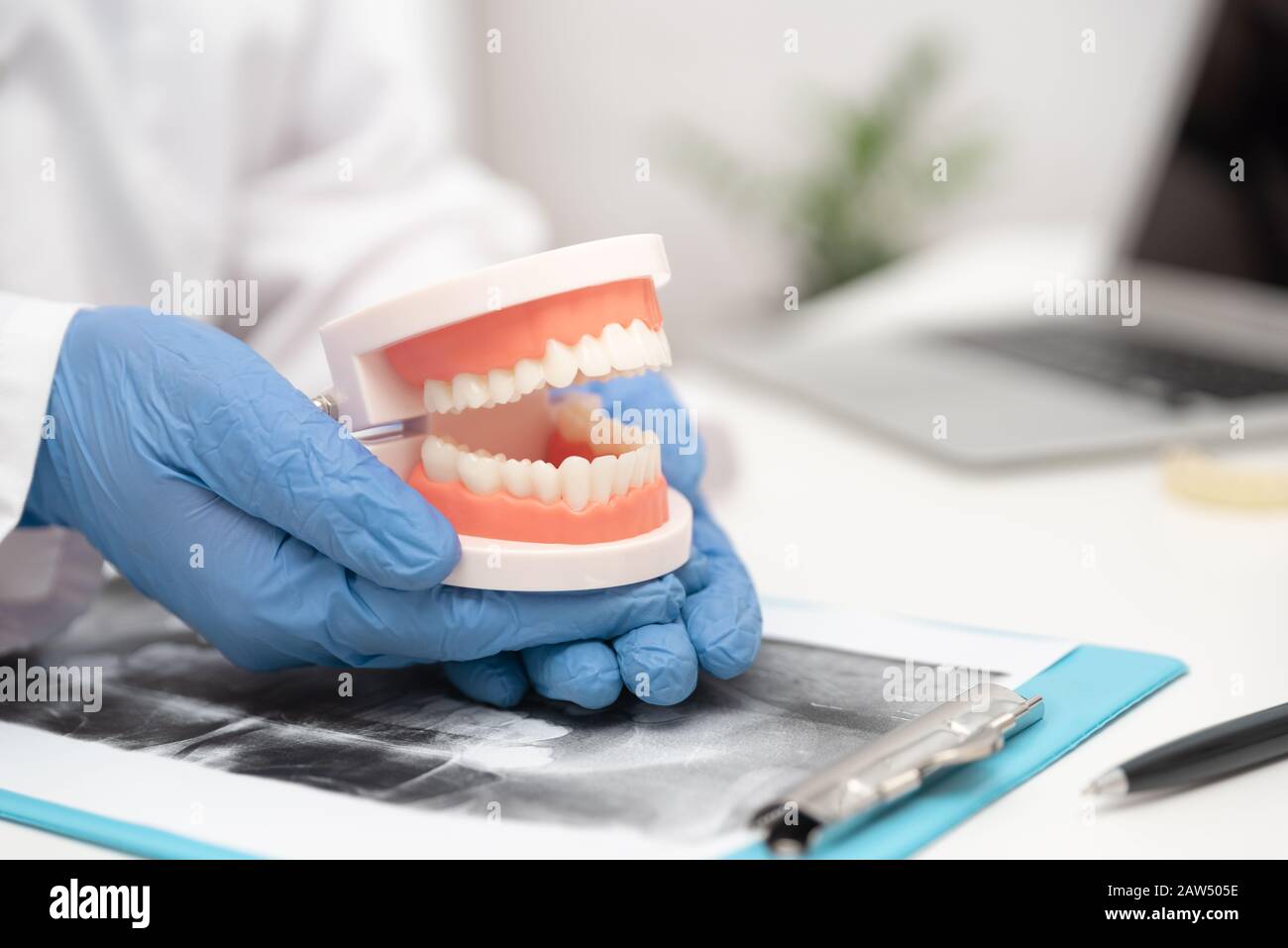 Doctor in the office holds the jaw. Dentist shows how to care for ...