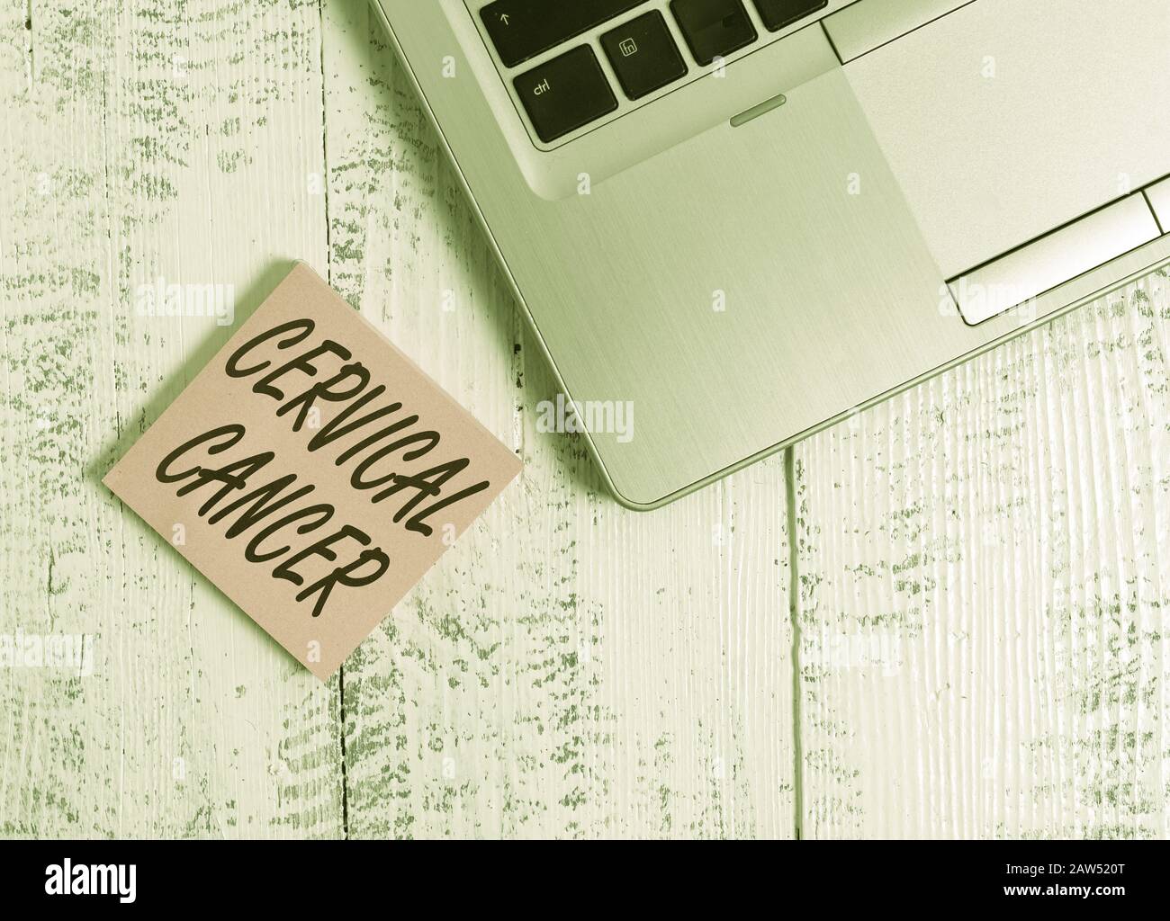 Word writing text Cervical Cancer. Business photo showcasing type of ...