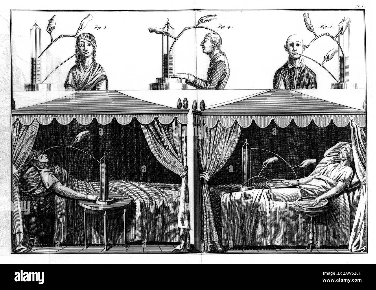 1804 , GREAT BRITAIN : Human experiment with electricity , Plate 5 ...