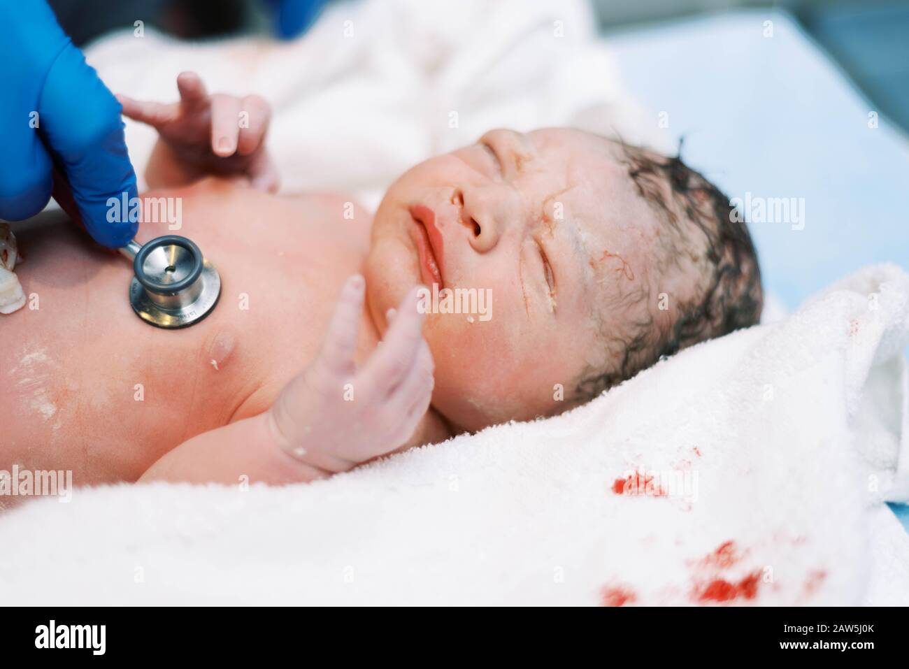 Blue Baby Operation High Resolution Stock Photography and Images - Alamy