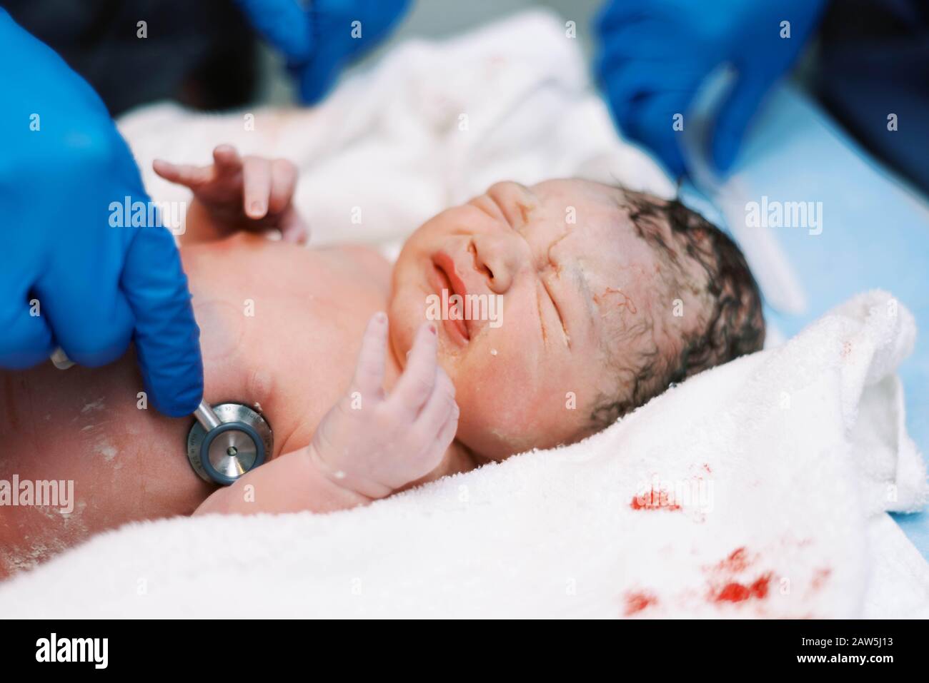 Blue baby operation hi-res stock photography and images - Alamy