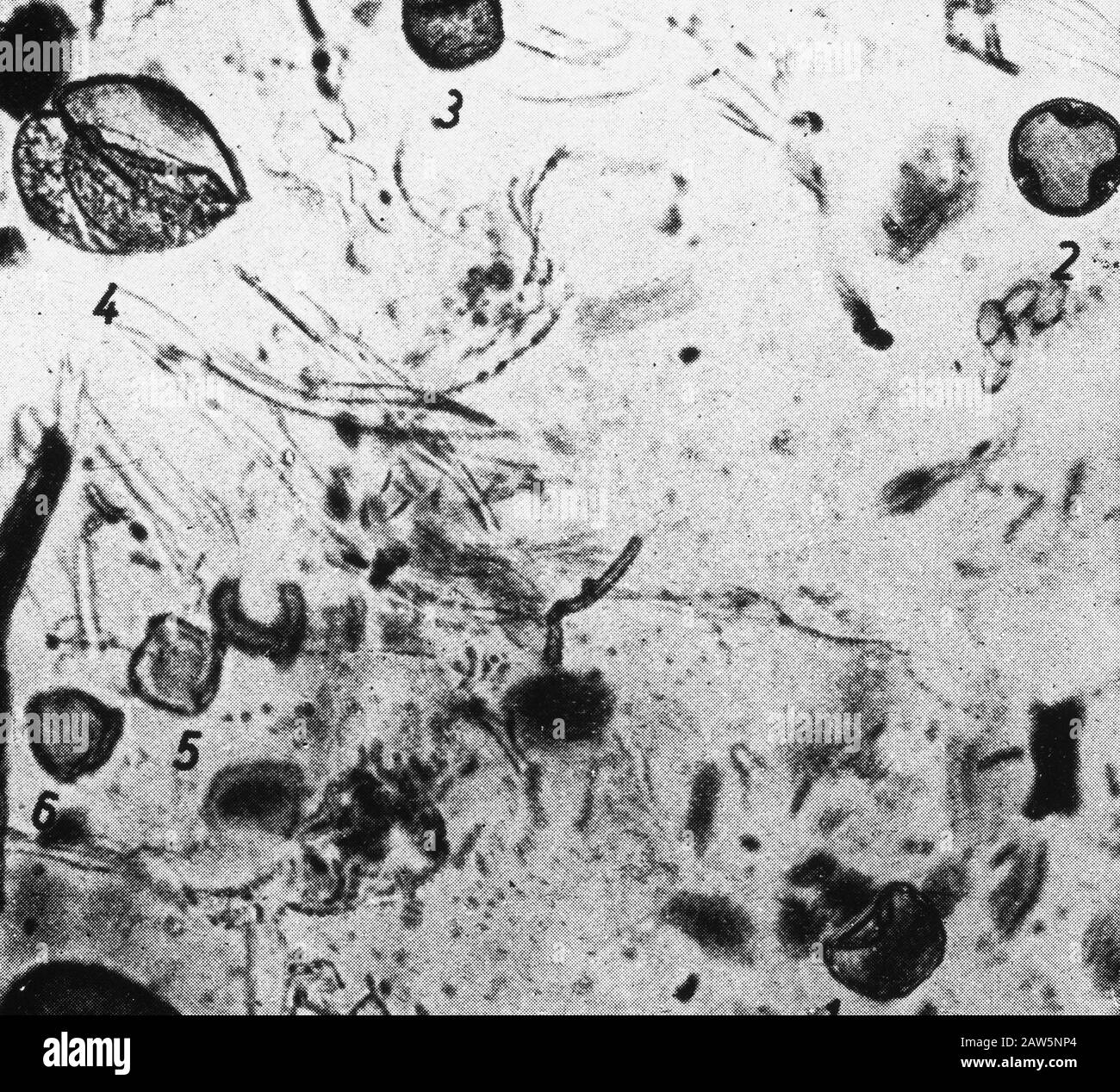 Hazel identification Black and White Stock Photos & Images - Alamy