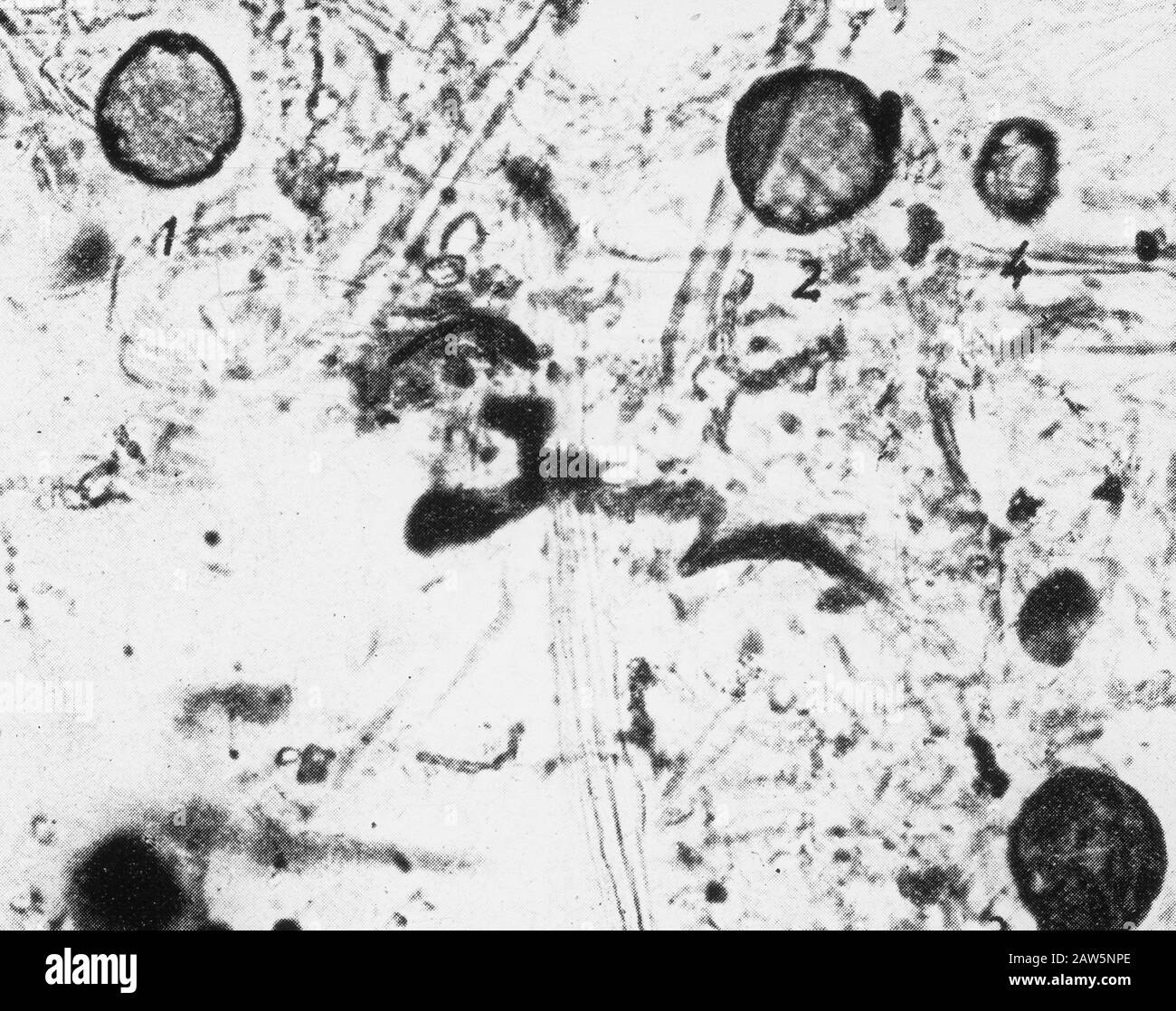Micrograph tree Black and White Stock Photos & Images - Alamy