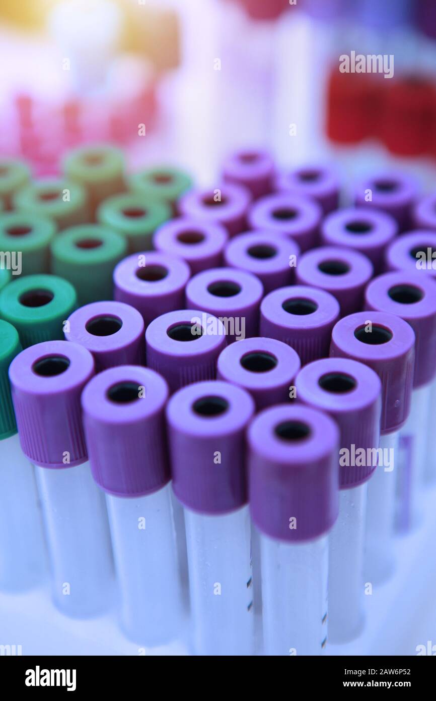 Blood sample for testing.Medical equipment Stock Photo - Alamy