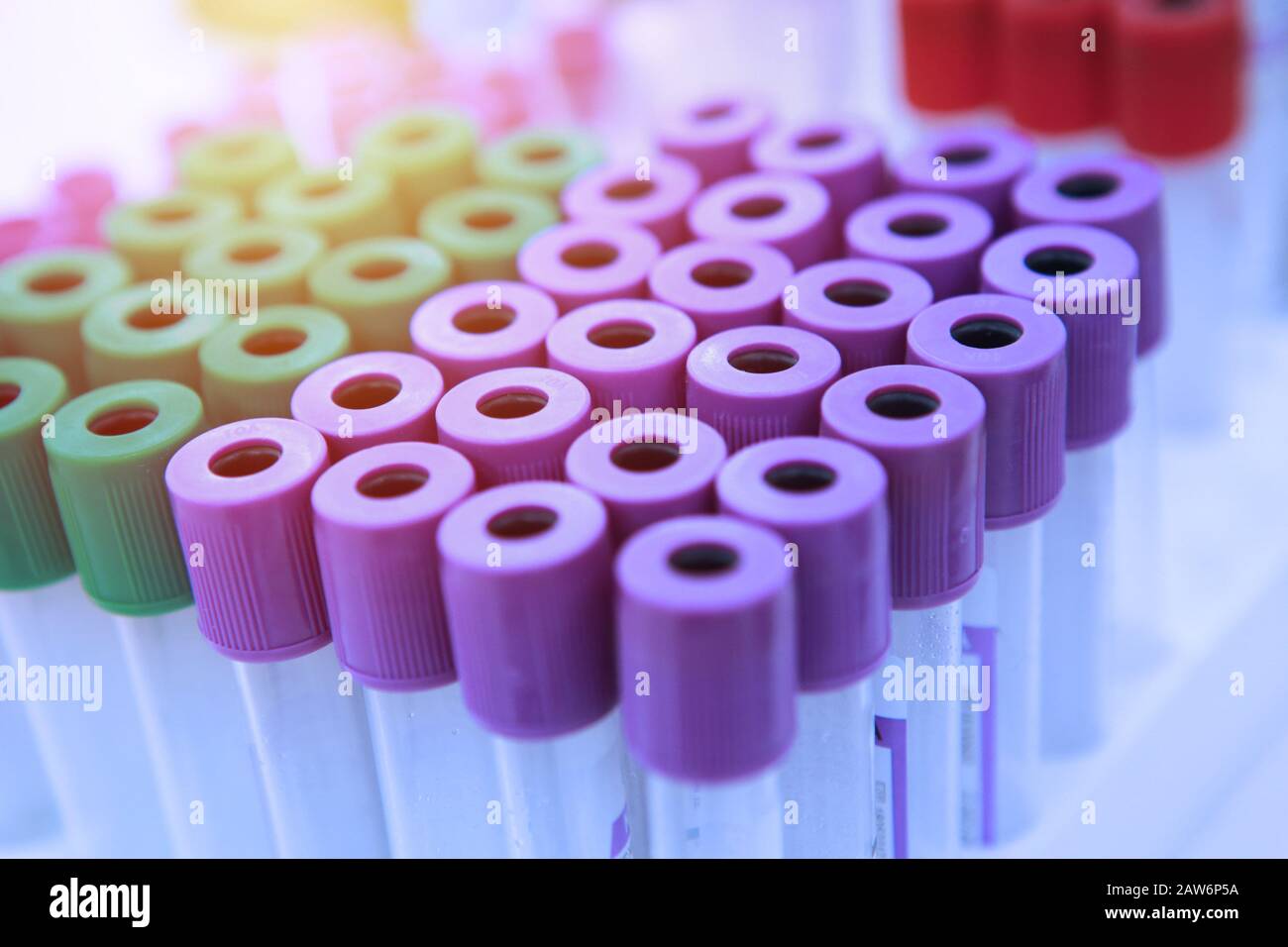 Blood sample for testing.Medical equipment Stock Photo - Alamy