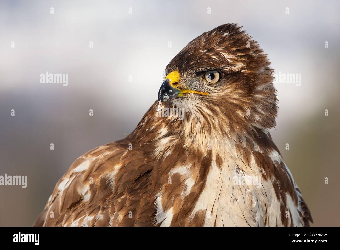 Common eye conditions hi-res stock photography and images - Alamy