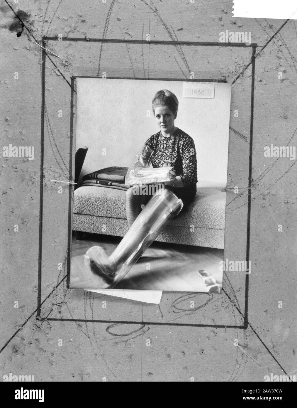 Splinting hi-res stock photography and images - Alamy