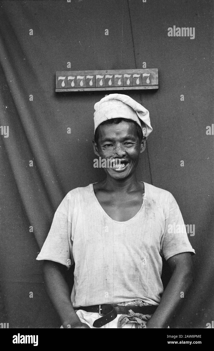 Disfigured face hi-res stock photography and images - Alamy