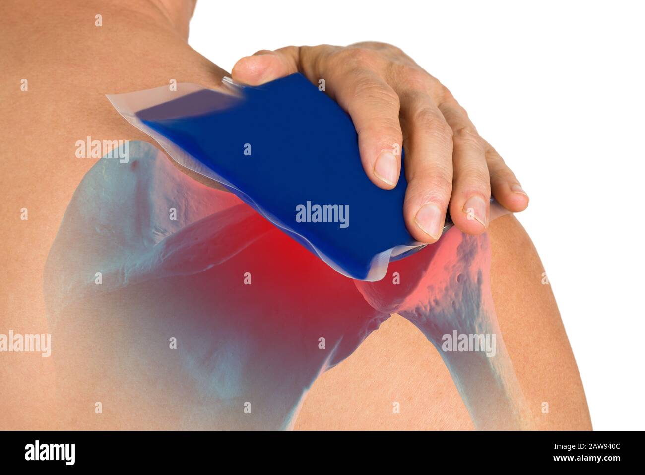 Shoulder strains hi-res stock photography and images - Alamy