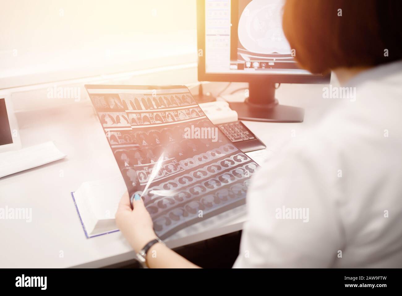 Magnetic resonance imaging. Doctor MRI scan results of diagnosis cancer ...