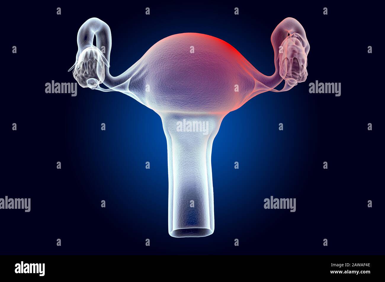 Pain in Uterus concept. Ghost light effect, x-ray hologram. 3D ...