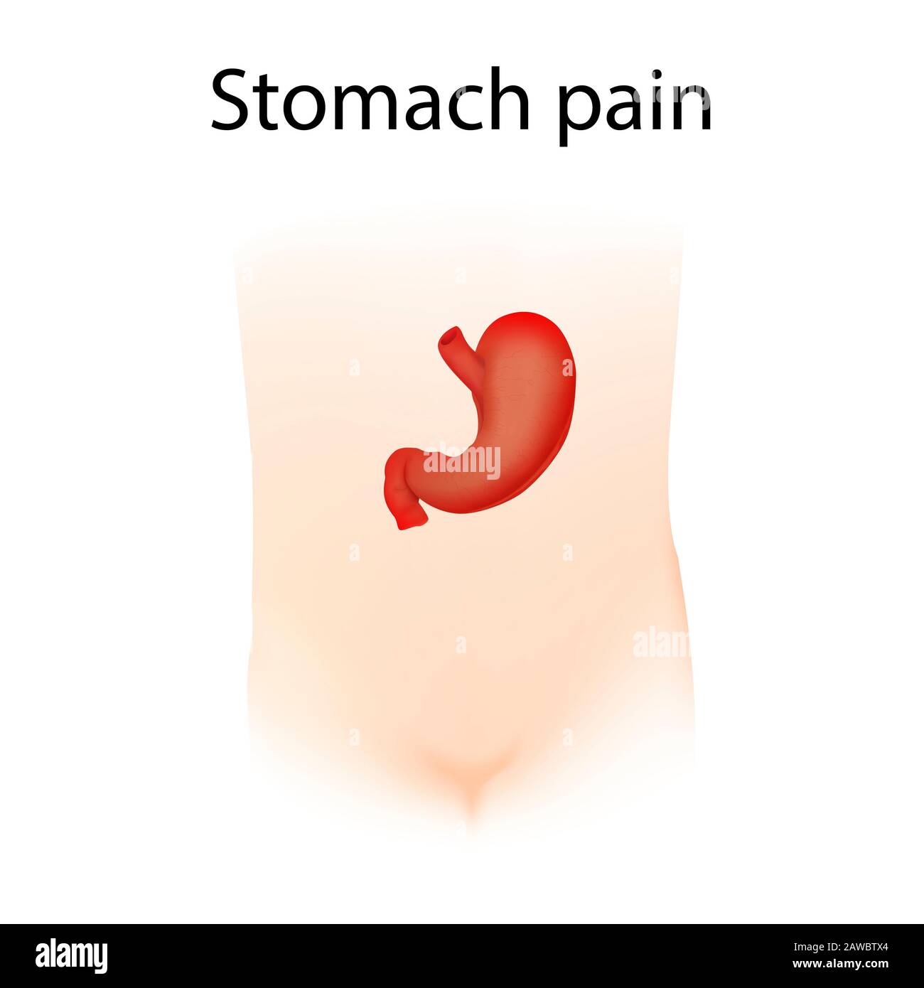 Gastritis and painful human condition Cut Out Stock Images & Pictures ...