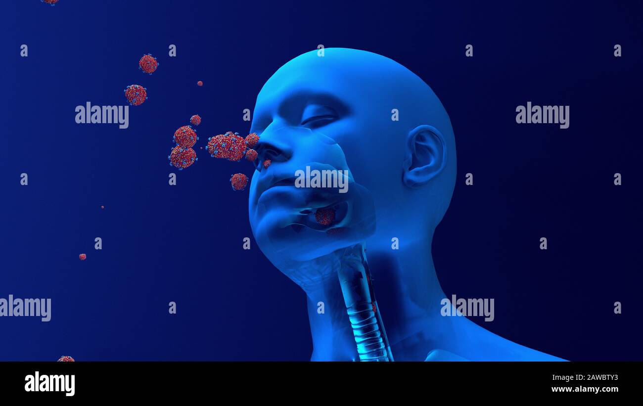 Chest infection hi-res stock photography and images - Alamy