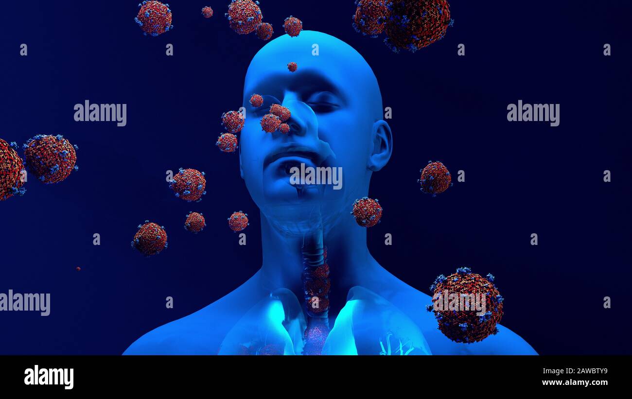 Chest infection hi-res stock photography and images - Alamy