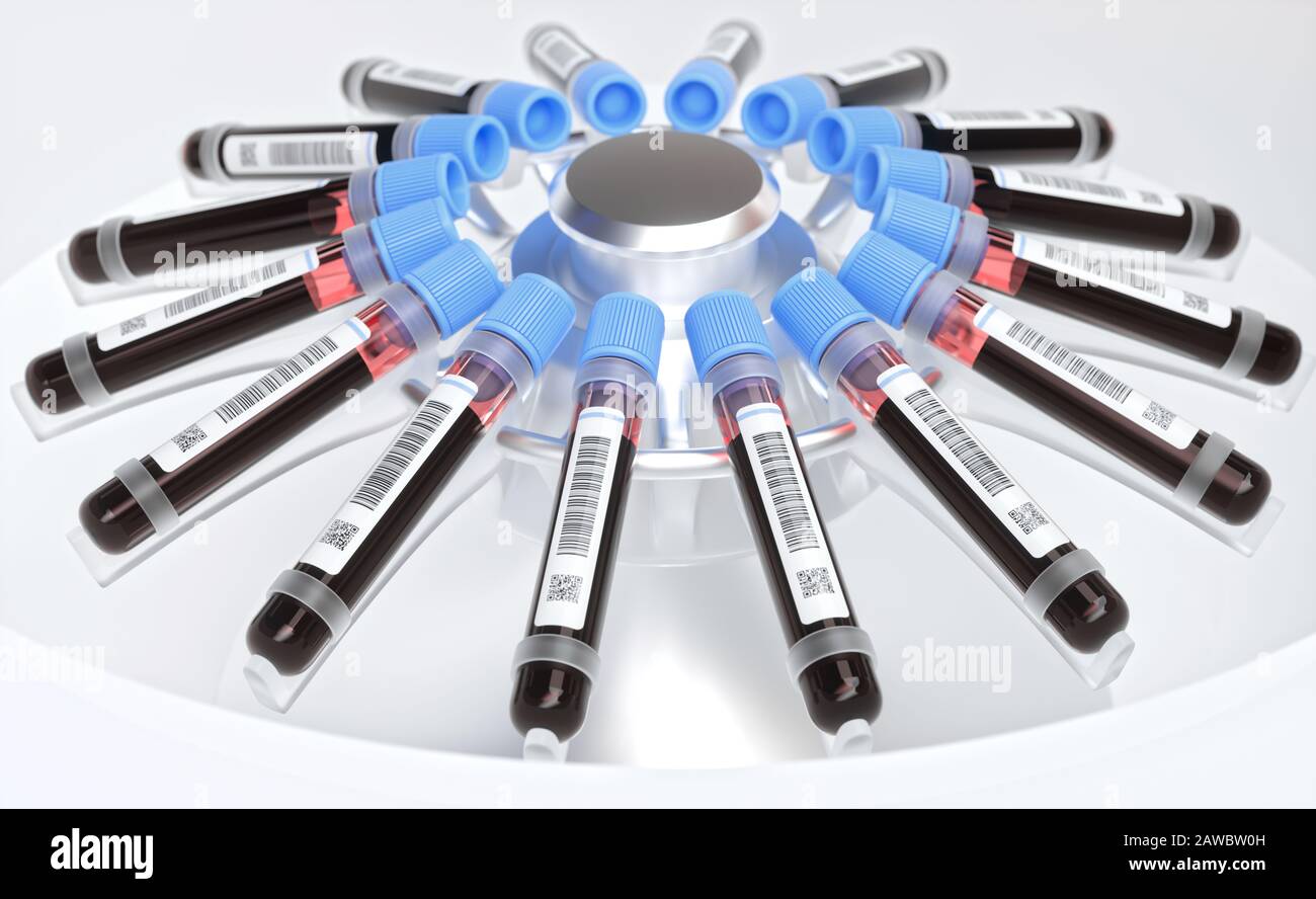 Phial of blood hi-res stock photography and images - Alamy