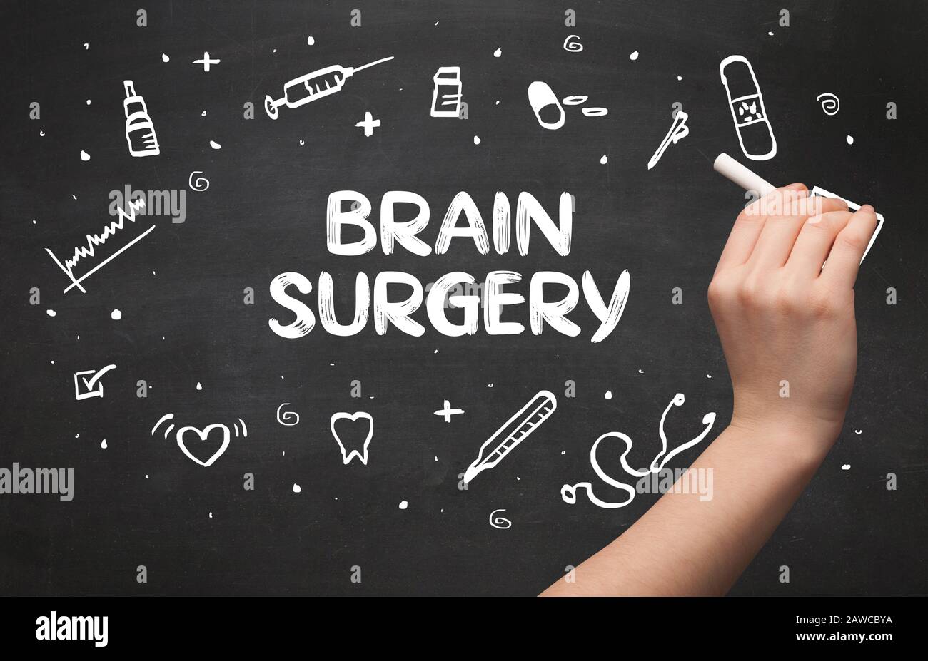 Hand drawing BRAIN SURGERY inscription with white chalk on blackboard ...