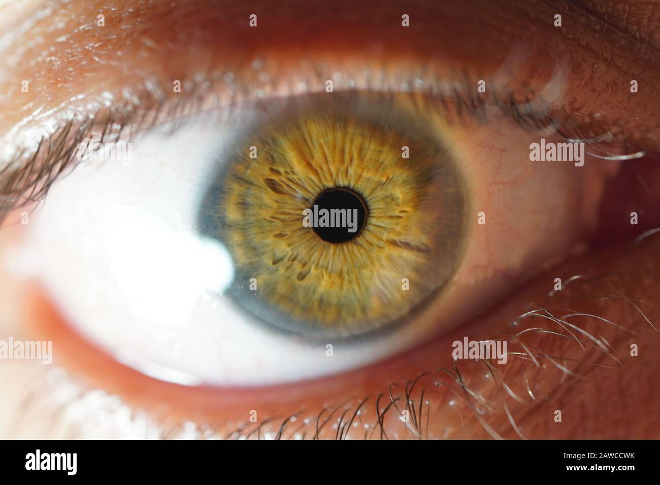 Actual Human Eye