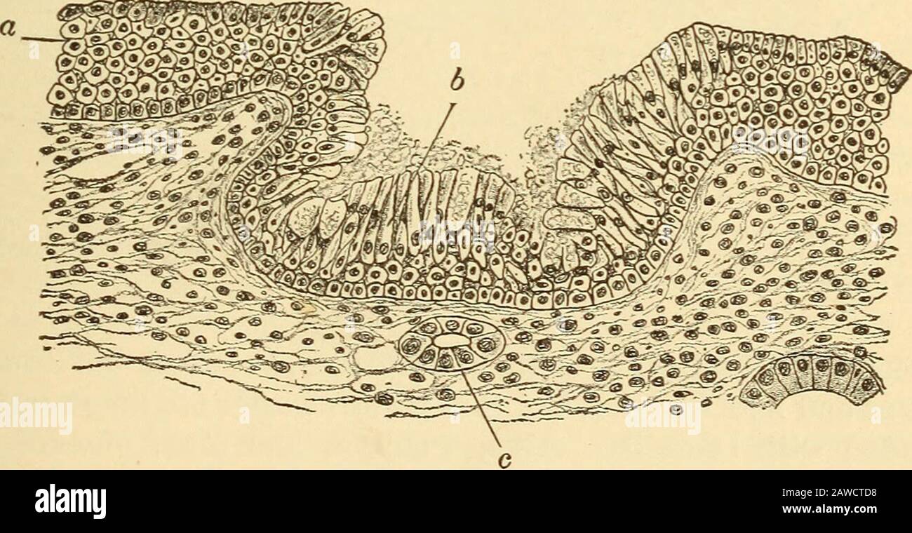 Pale Nasal Turbinates