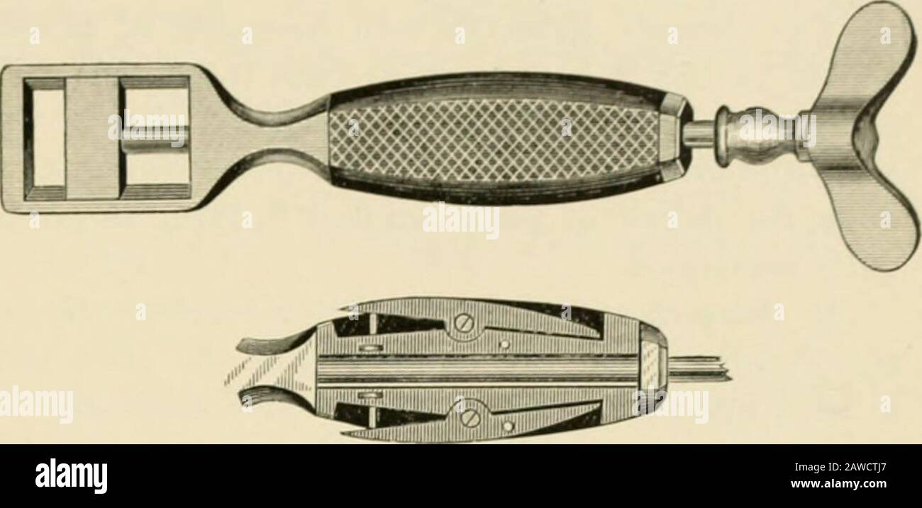 Operative surgery . Fig. 1192.—Operation for the cure of haemorrhoids ...