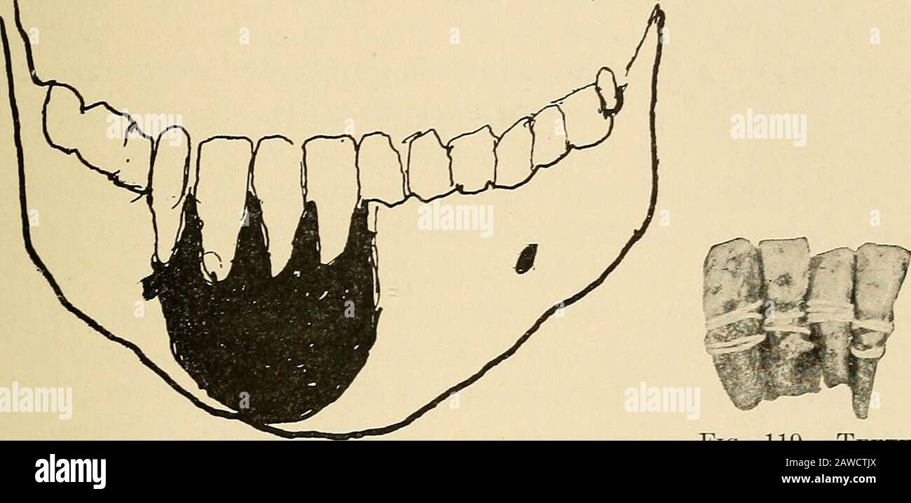 Oral surgery; a text-book on general surgery and medicine as applied to ...