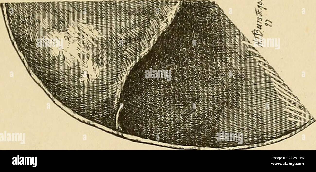 The normal and pathological circulation in the central nervous system ...