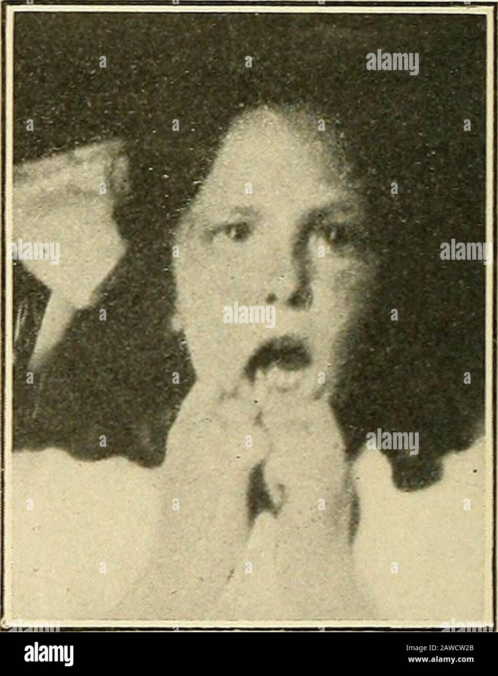 Y incision hi-res stock photography and images - Alamy