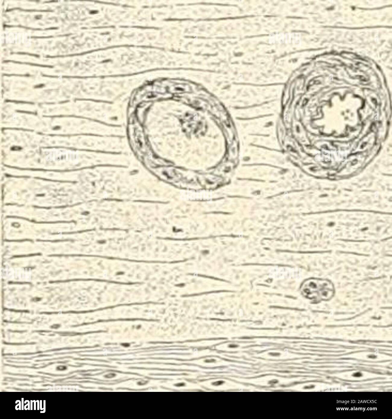 Mucous Membrane Mucosae High Resolution Stock Photography and Images ...