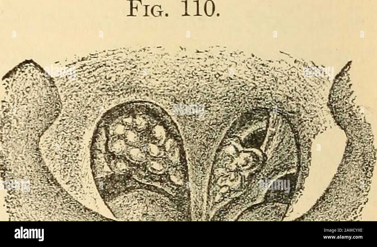 A text-book on diseases of the ear, nose and throat . Hypertrophy of ...