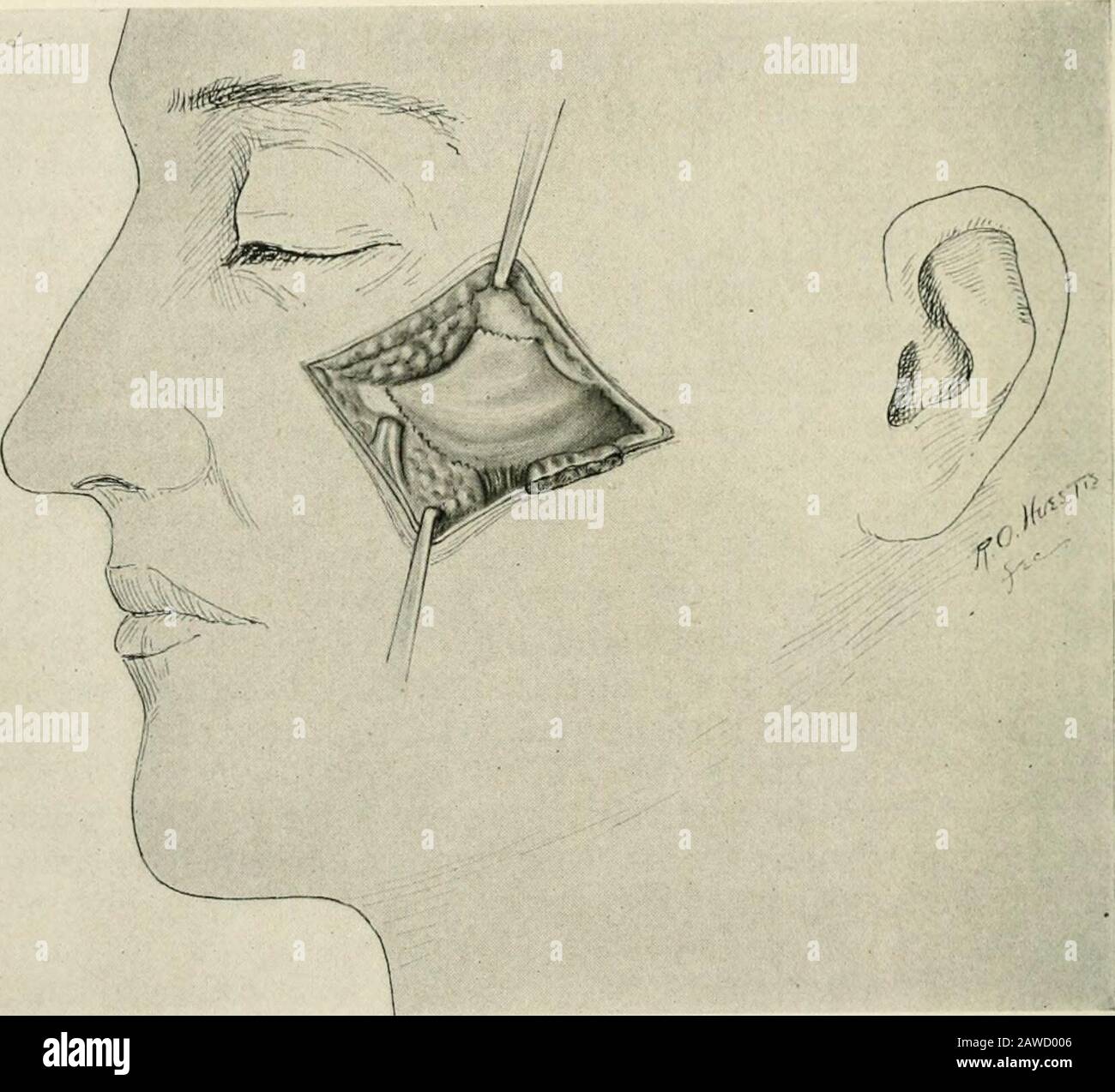 The practice of surgery . ain is due to carious teeth. We seepatients ...