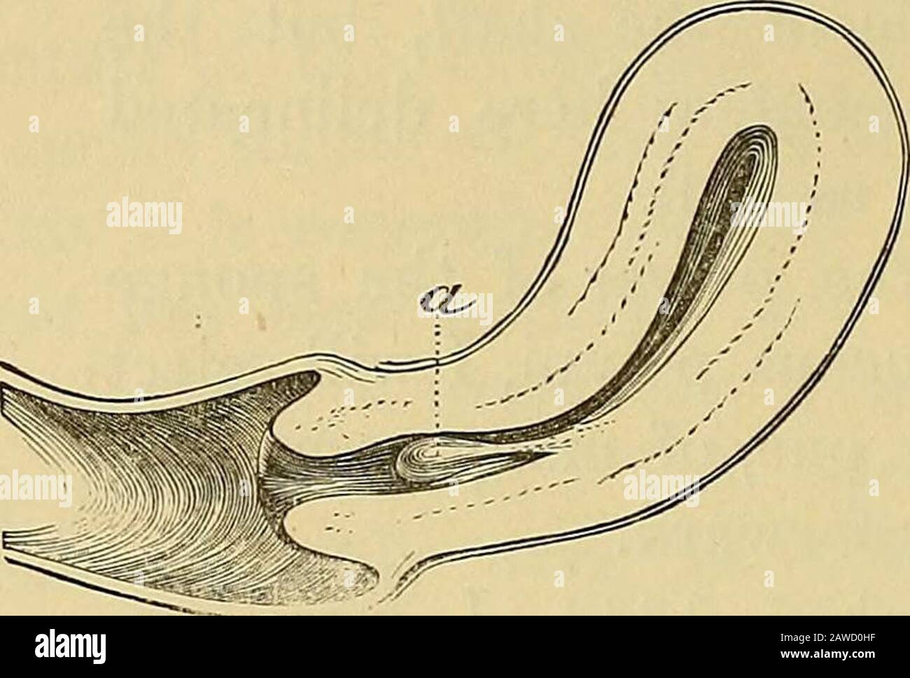 Cervical incision hi-res stock photography and images - Alamy