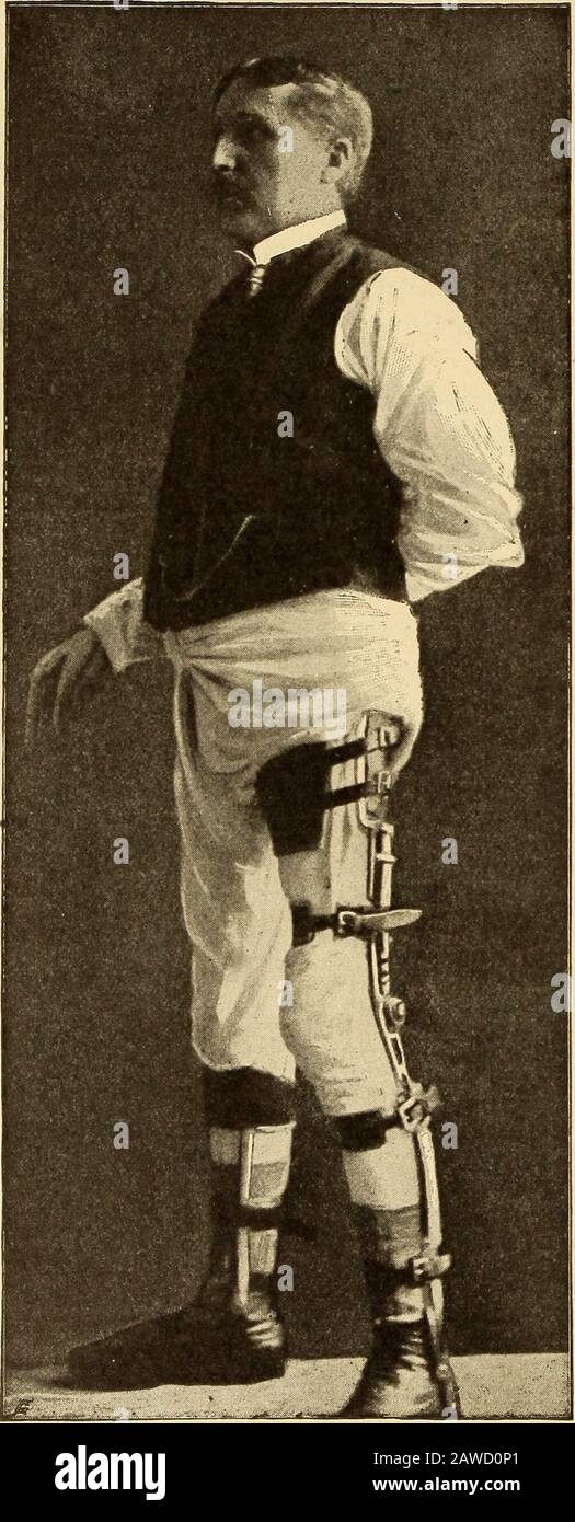 Musclepower hi-res stock photography and images - Alamy