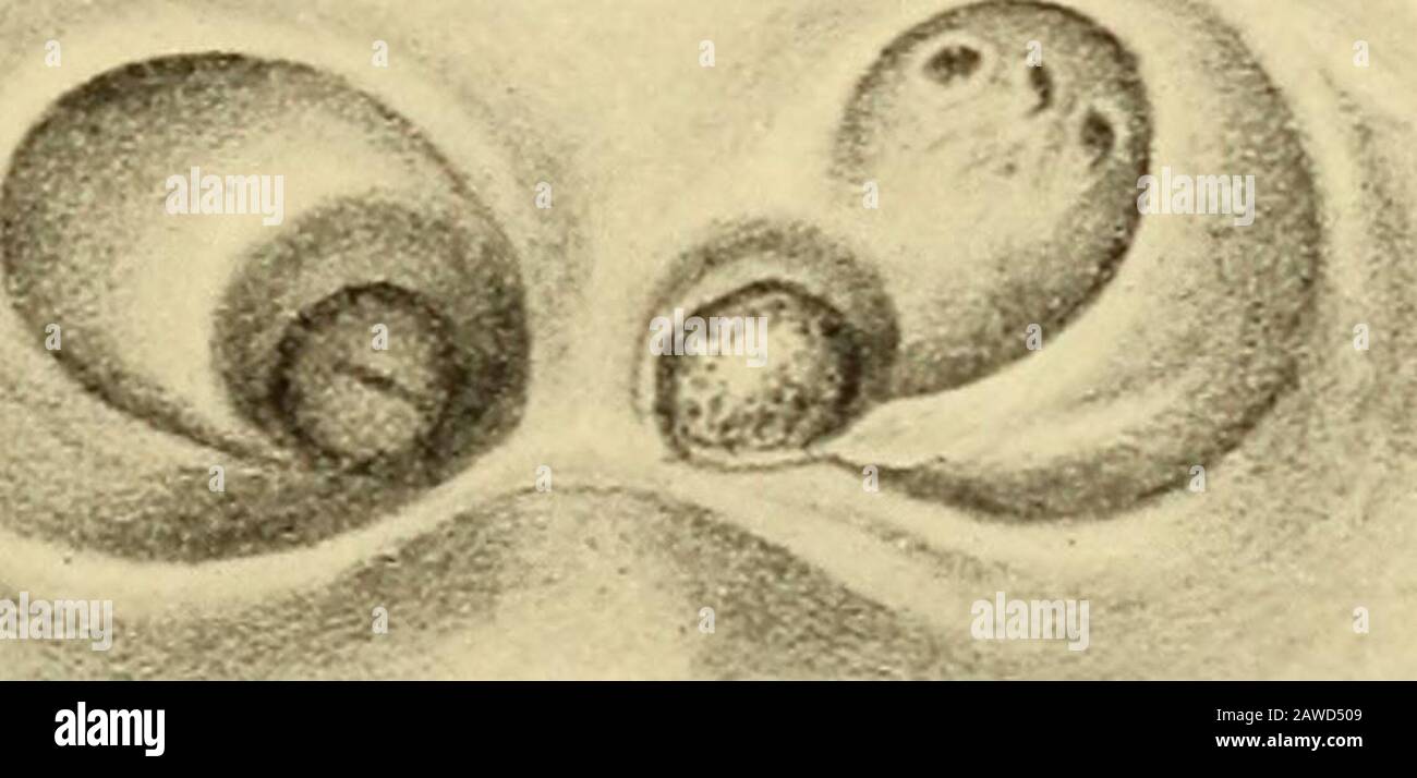 Diplococcus bacteria hi-res stock photography and images - Alamy