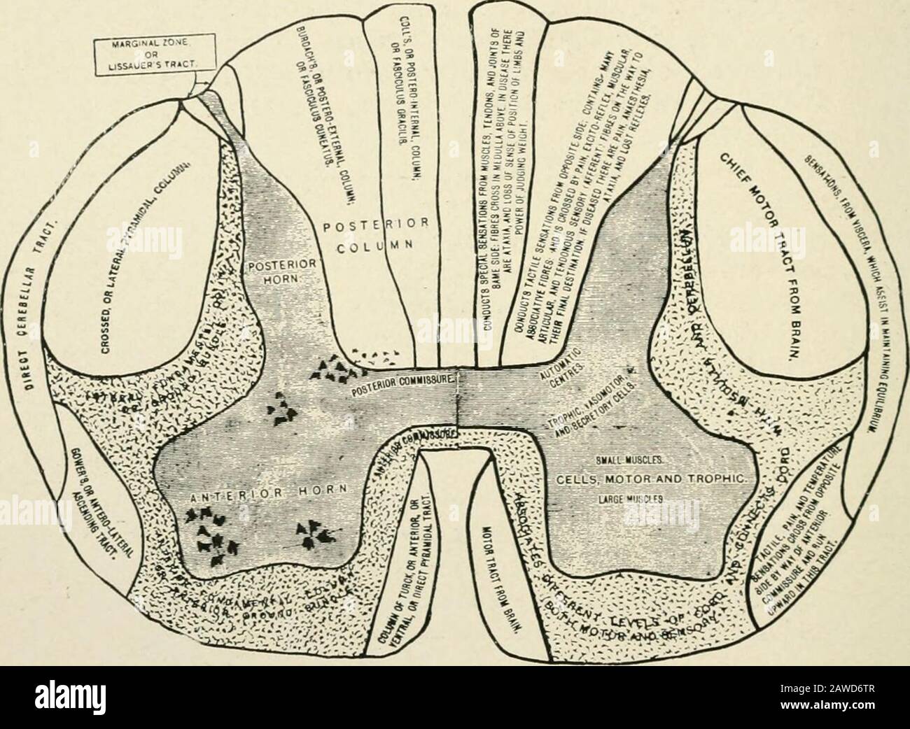 Spinal repair hi-res stock photography and images - Alamy