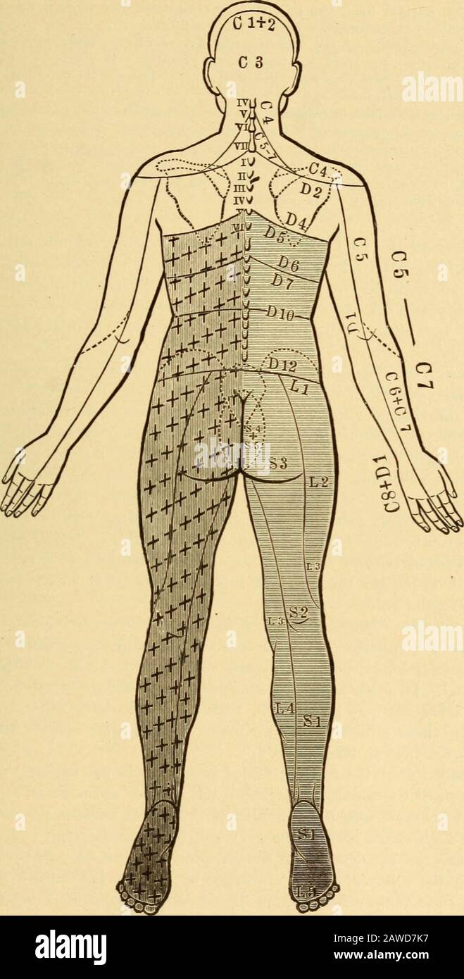 Diseases of the nervous system .. . Fig. 164.—Arrangement in Brown ...