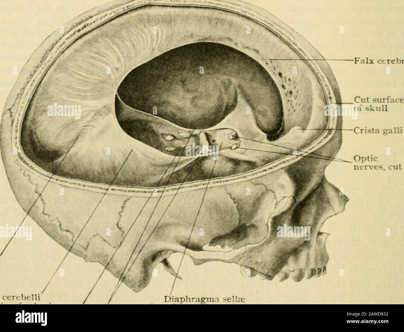 Cranial Dura Mater