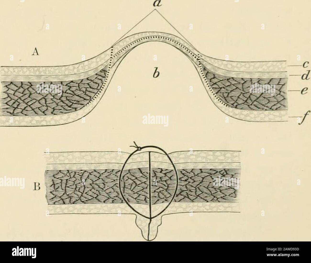 Inguinal region hi-res stock photography and images - Alamy