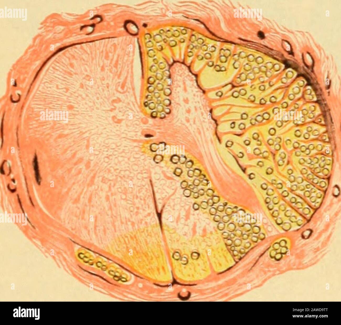 Diseases of the nervous system .. . girdle sensation,and pain in both ...