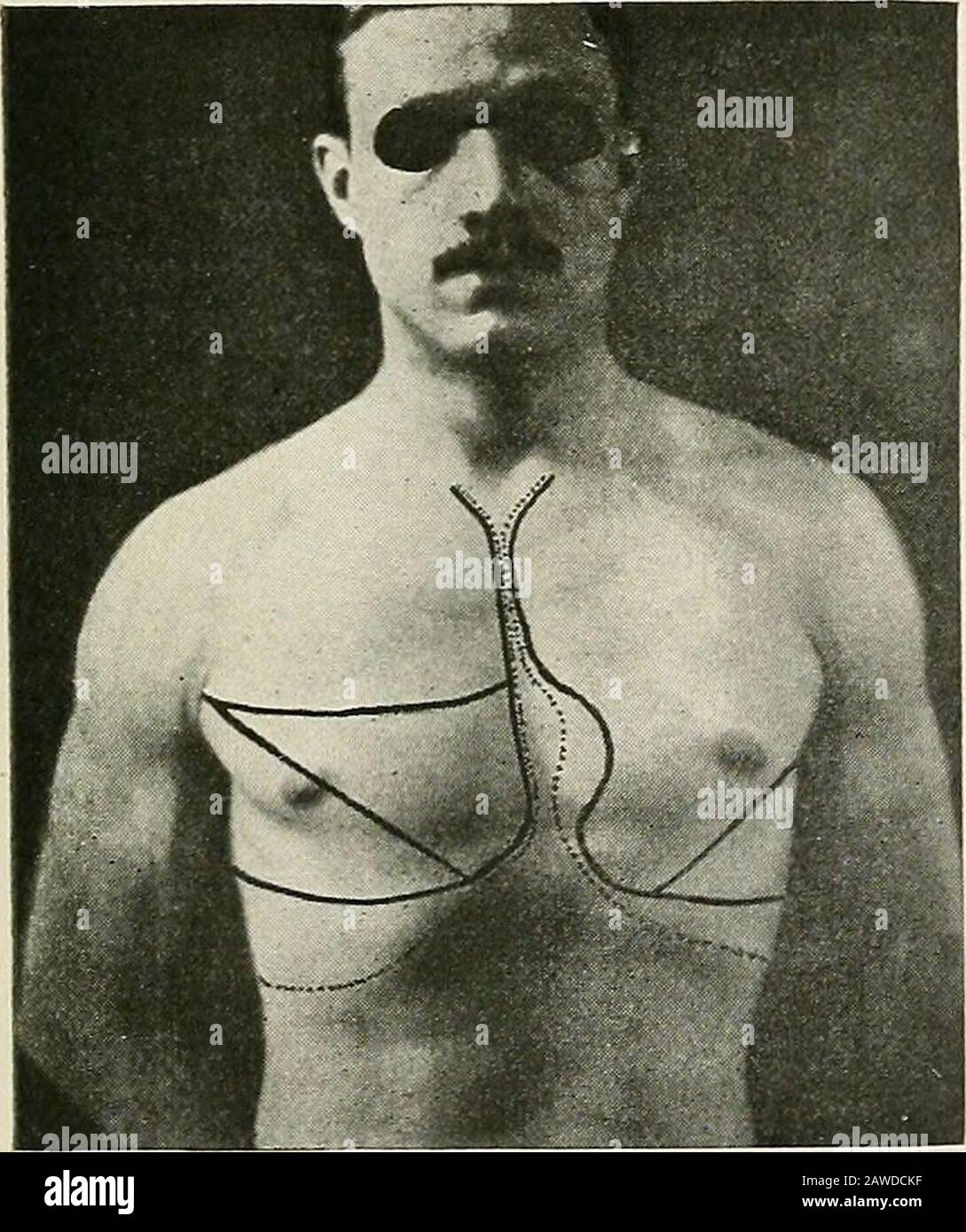 Diseases of the chest and the principles of physical diagnosis . Fig ...