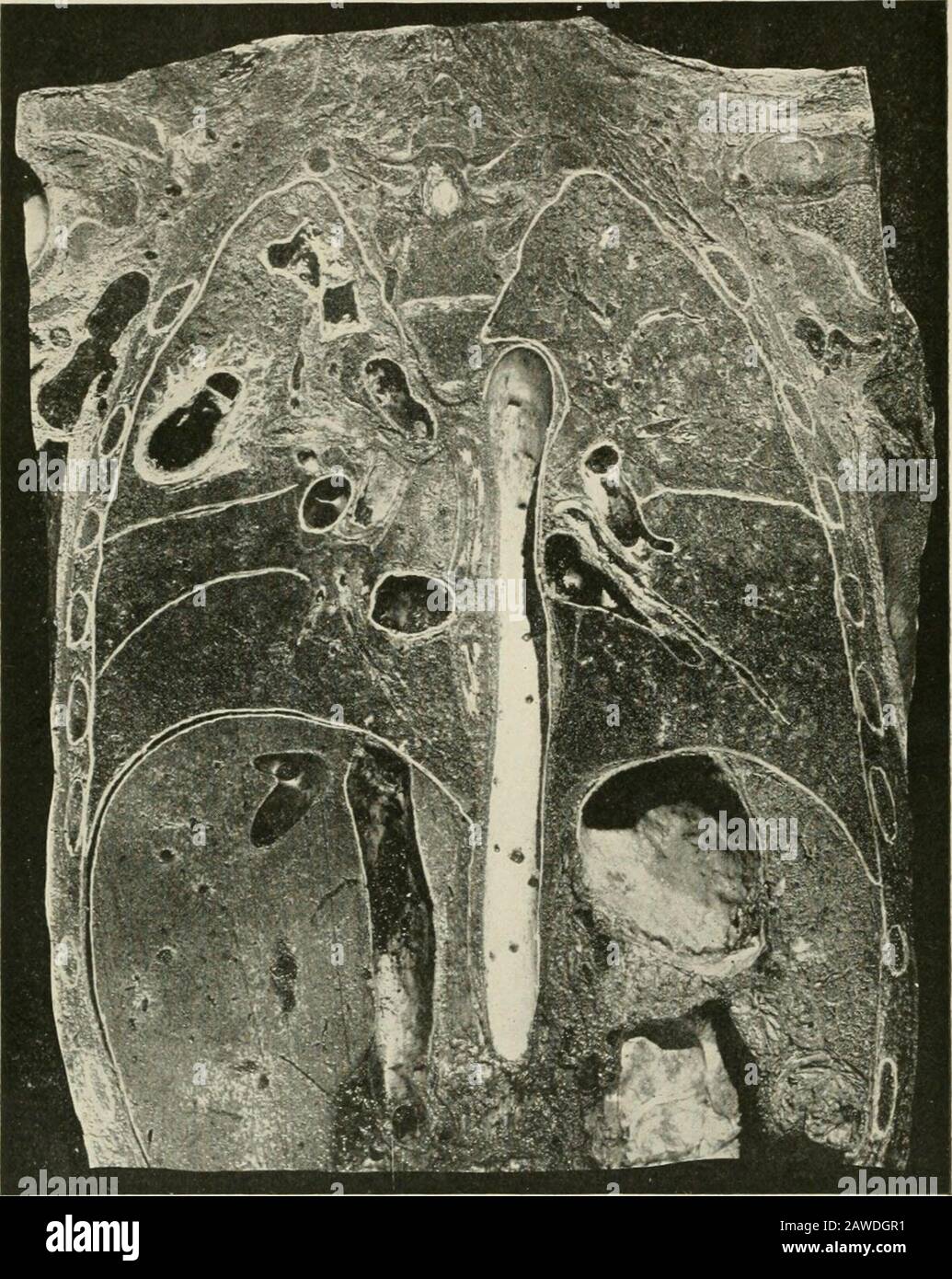 Diseases of the chest and the principles of physical diagnosis . Fig ...