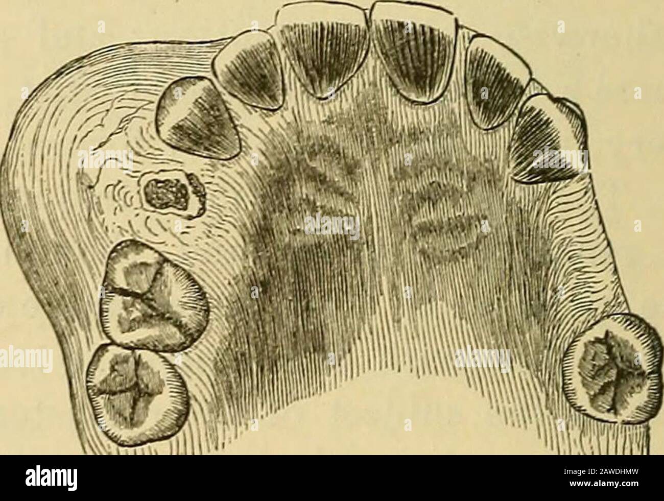 1803 surgery hi-res stock photography and images - Alamy