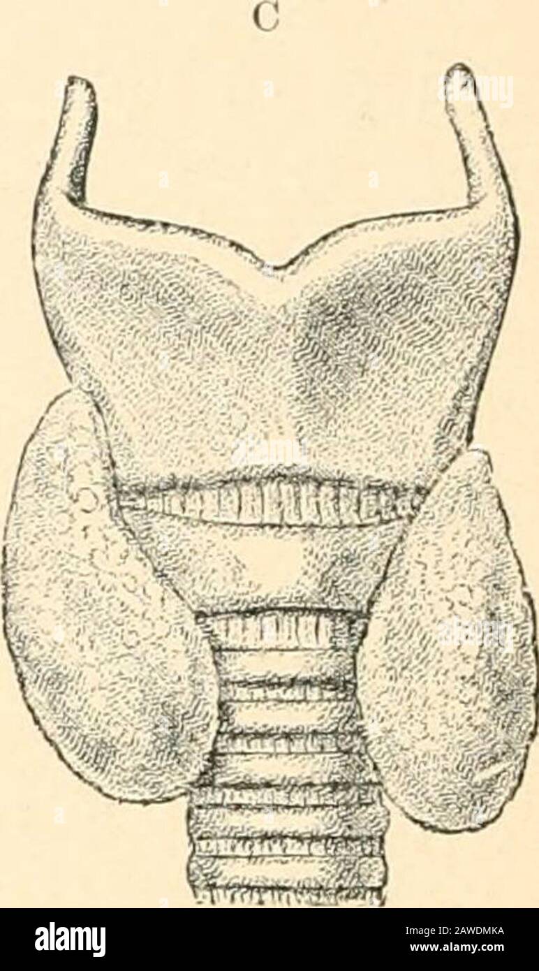 Pyramidal lobe of thyroid hi-res stock photography and images - Alamy