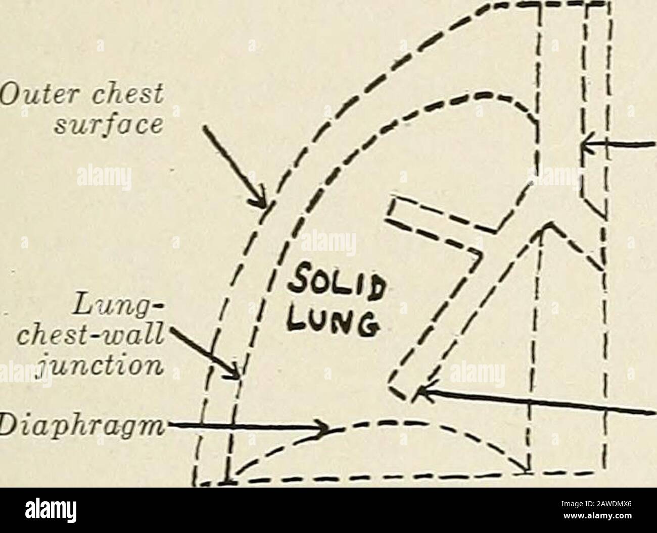 Diseases of the chest and the principles of physical diagnosis . Fig. D ...